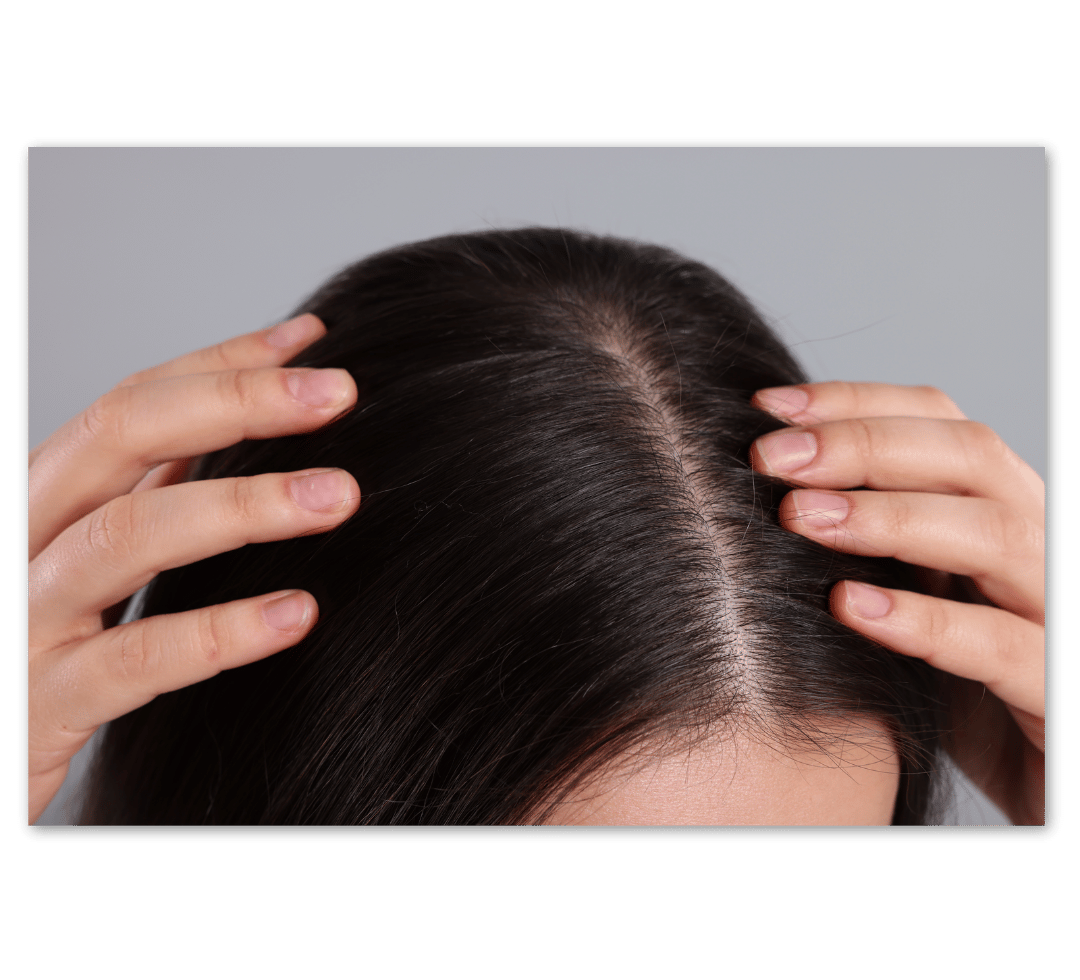 The Truth About Your Hair Growth Struggles— And How to Fix Them in 5 ...
